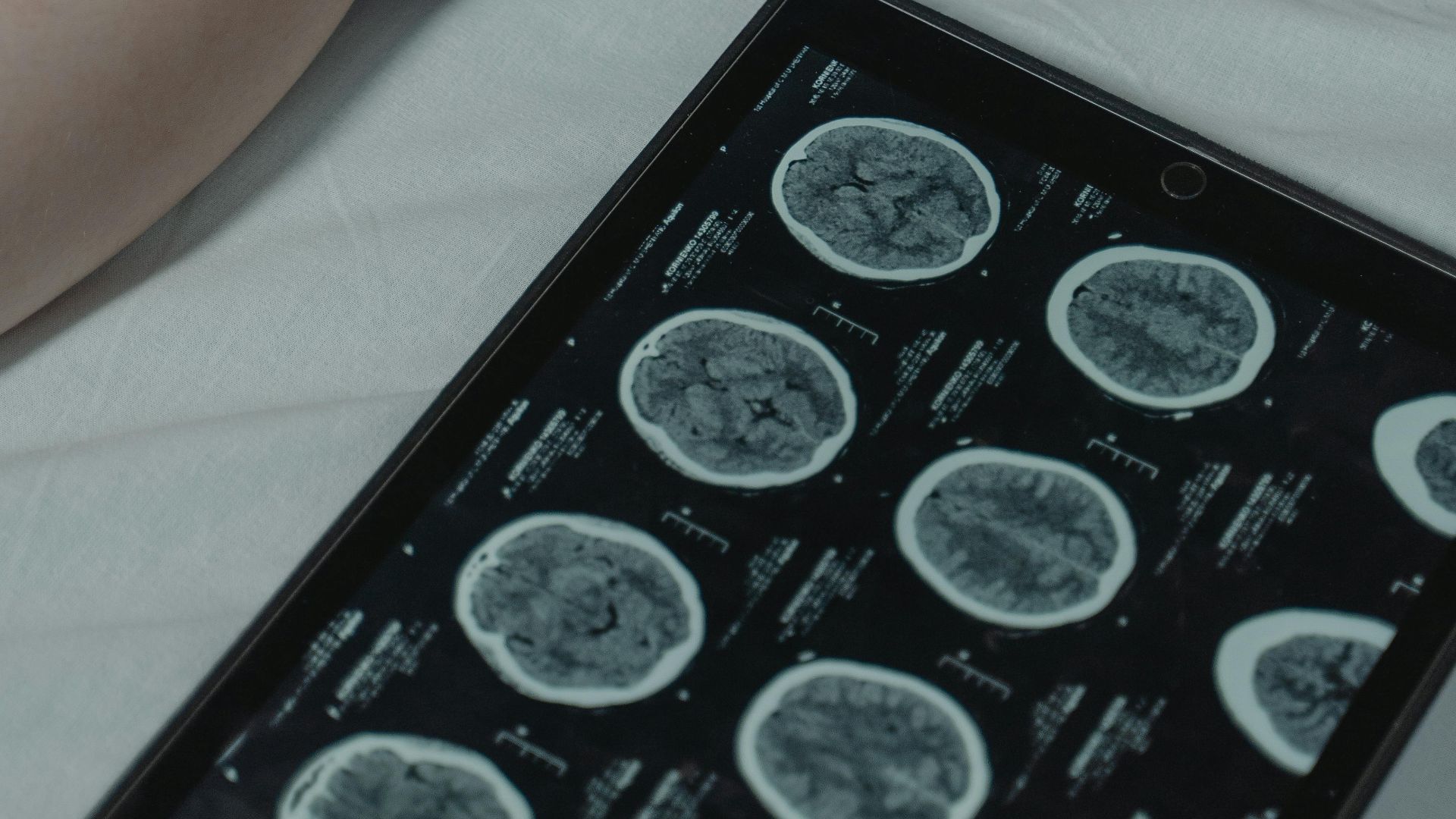 The 10 Deadliest Forms Of Cancer & The 10 Most Curable - HealthByWealth