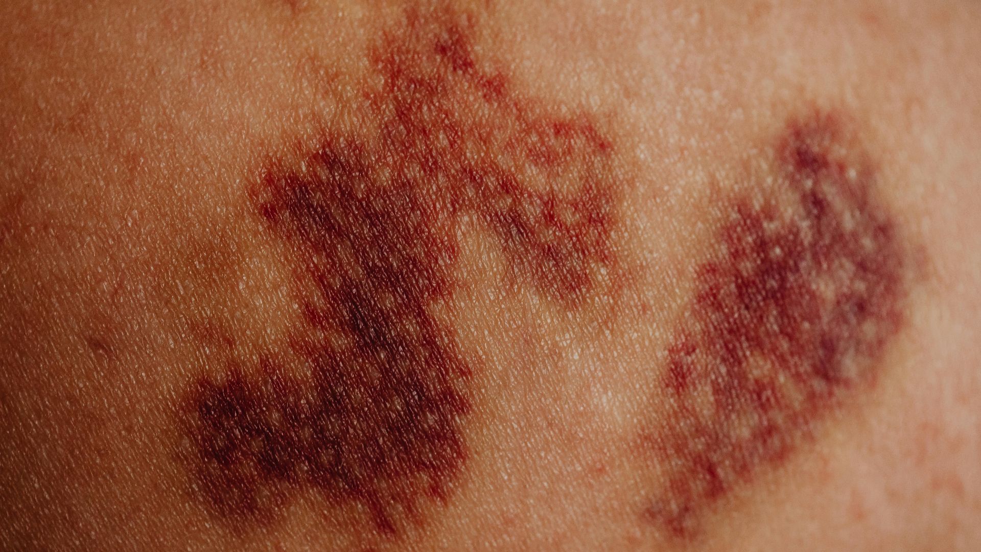 The 10 Deadliest Forms Of Cancer & The 10 Most Curable - HealthByWealth